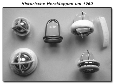 KlappenOP | Herz-Lungen-Maschine